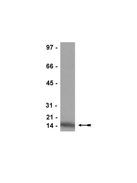 Anti-TCL1 Antibody | 05-954